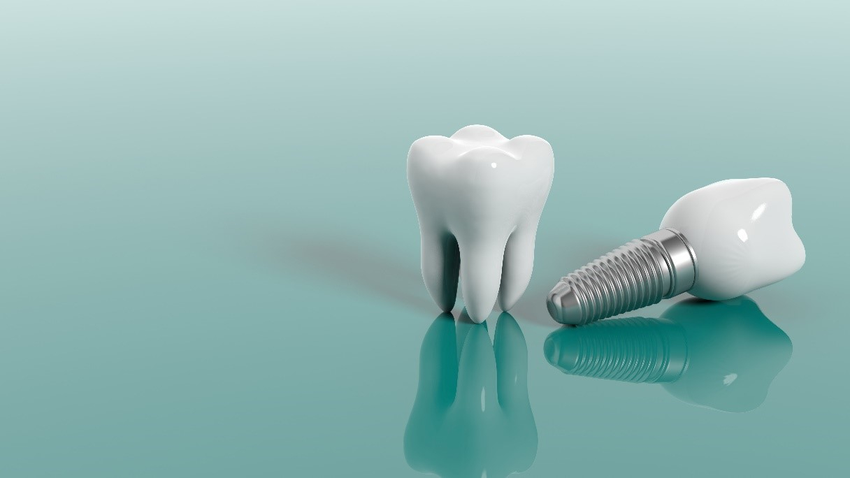 Innovations in Dental Implant Evolution